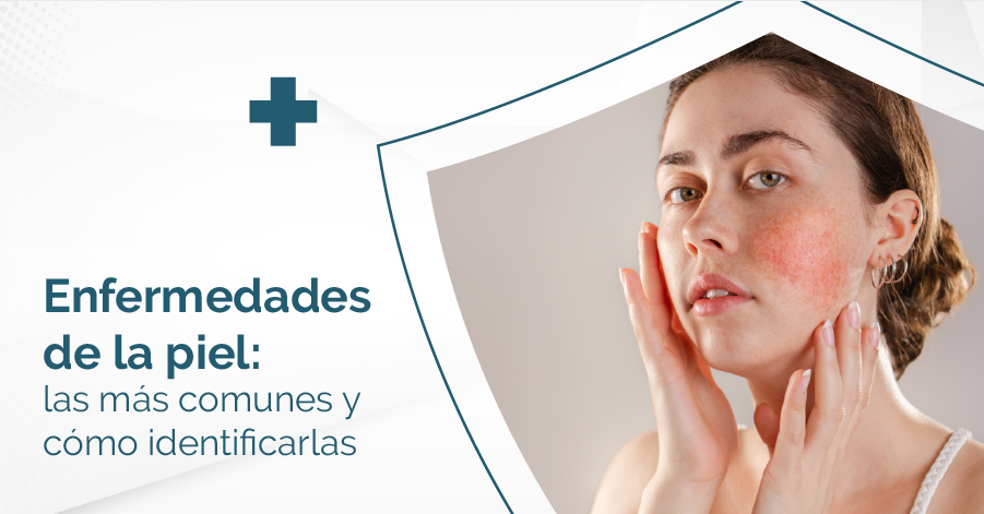 Enfermedades de la piel: las más comunes y cómo identificarlas